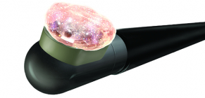 Otopront Smart - Den mobile løsningen - kompakt og anvendelig - Øre ...